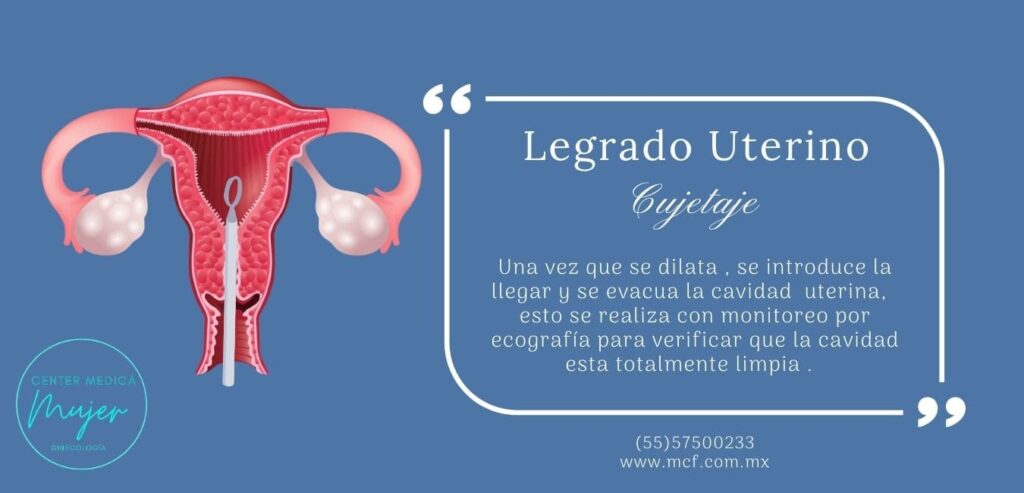 Nuevo Embarazo Después De Un Legrado – NQETJ